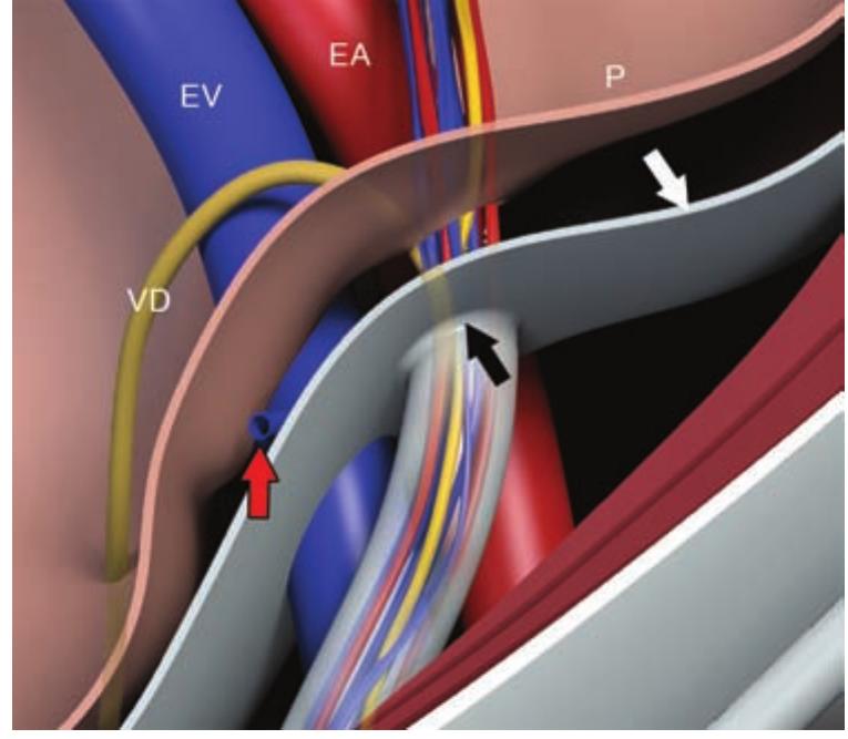 Coronal diagram of the male inguinal anatomy. the deep