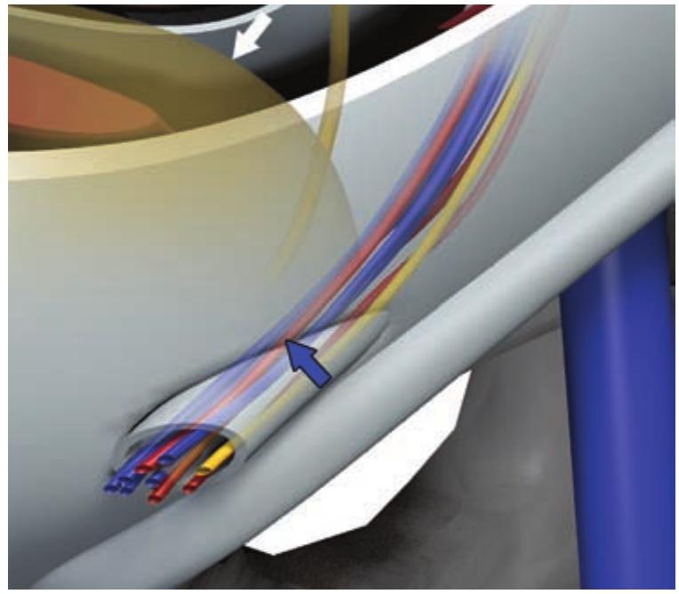 Coronal diagram of the male inguinal anatomy. the