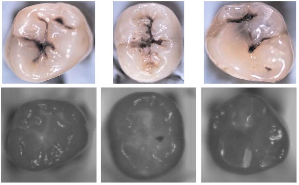 Figure 7 - from Near-infared hyperspectral imaging of teeth