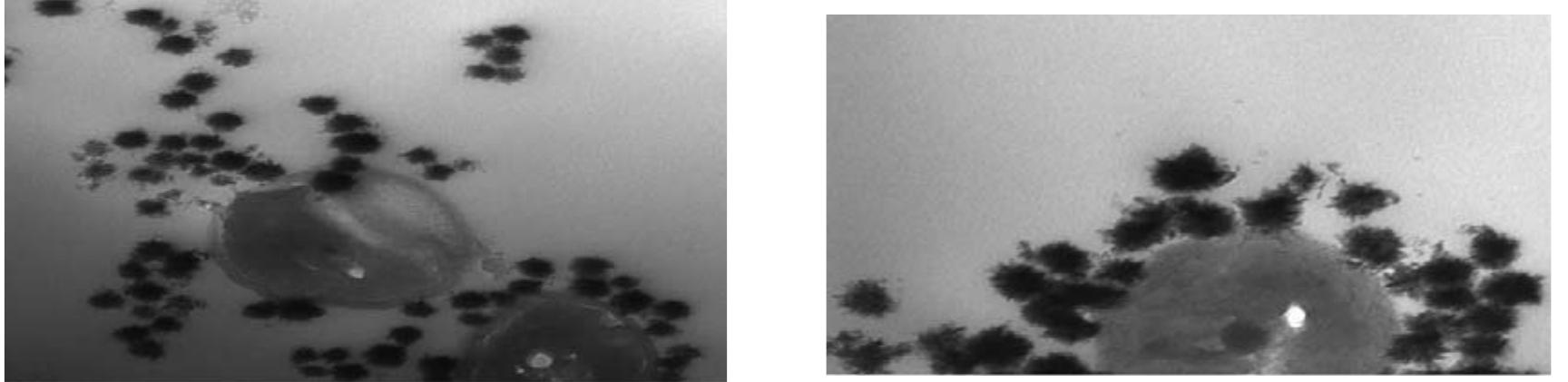 The previous photos (a, b, c & d) showed bacterial cells