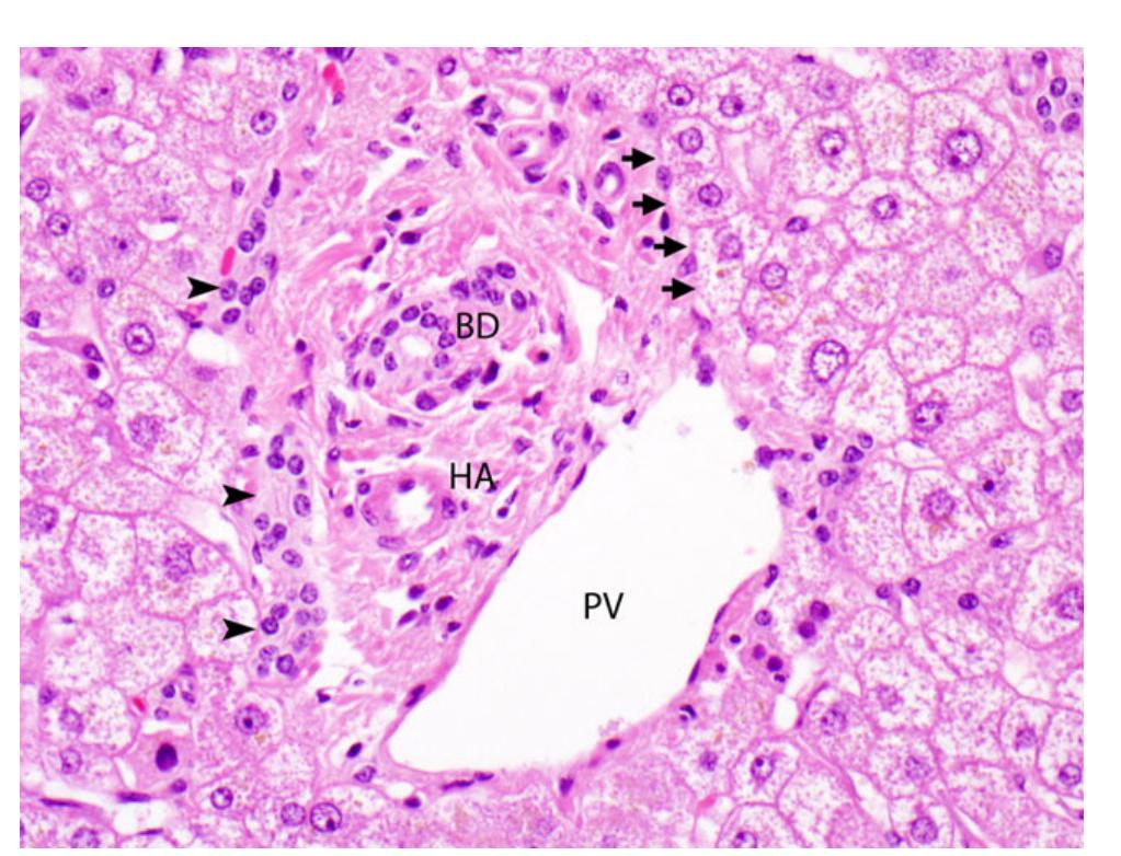 (PDF) Microscopic anatomy of the liver