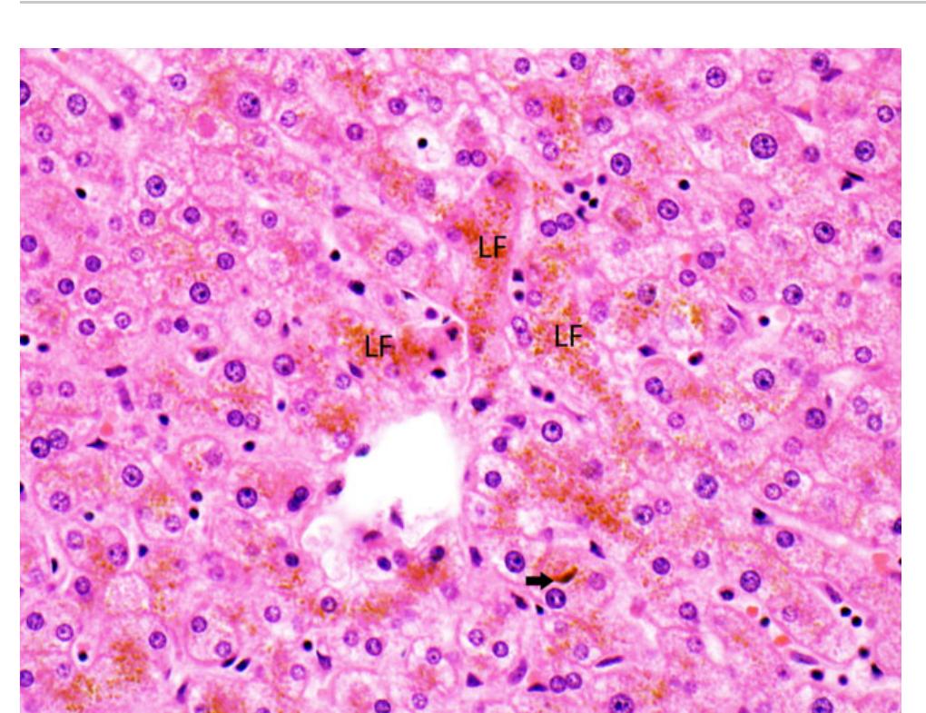 (PDF) Microscopic anatomy of the liver