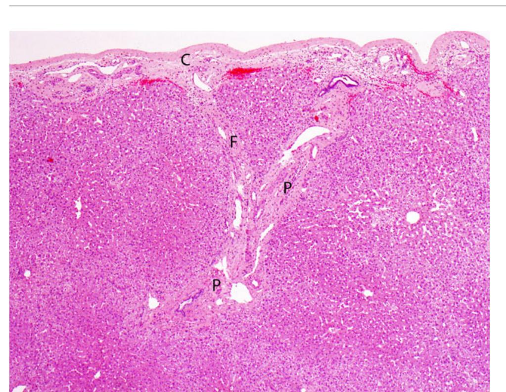 (PDF) Microscopic anatomy of the liver