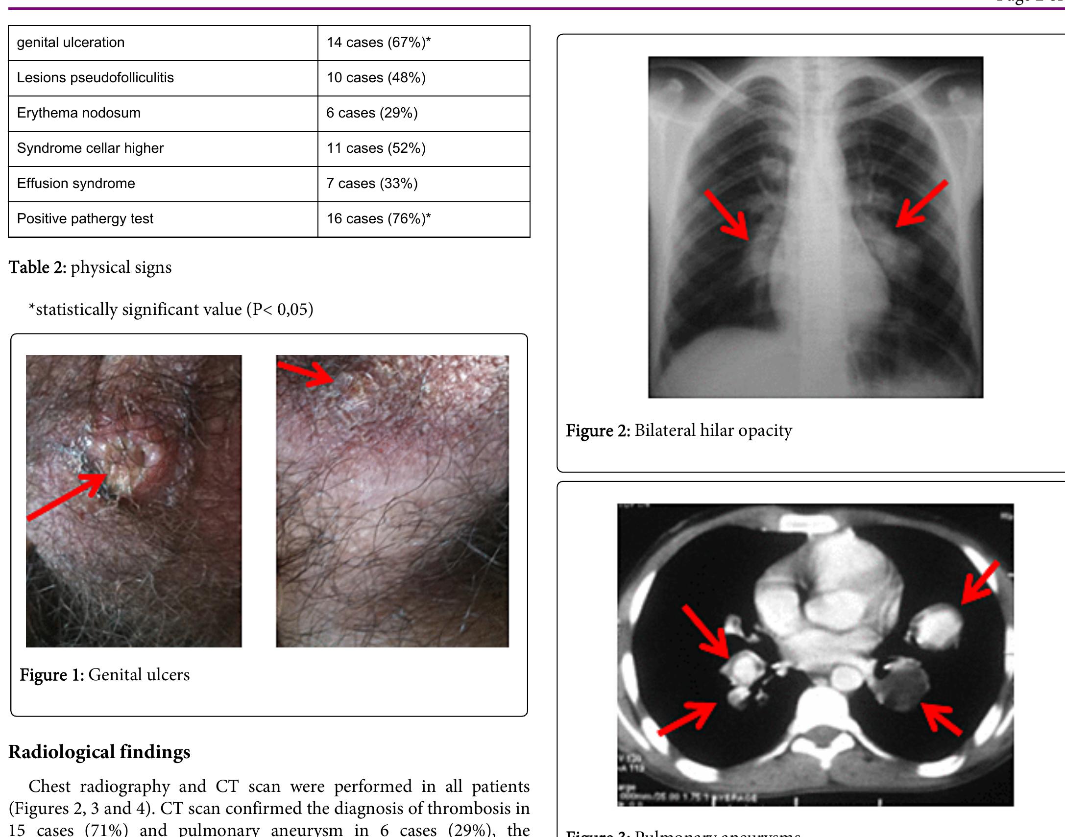 Physical signs figure 2: bilateral hilar opacity figure 1: