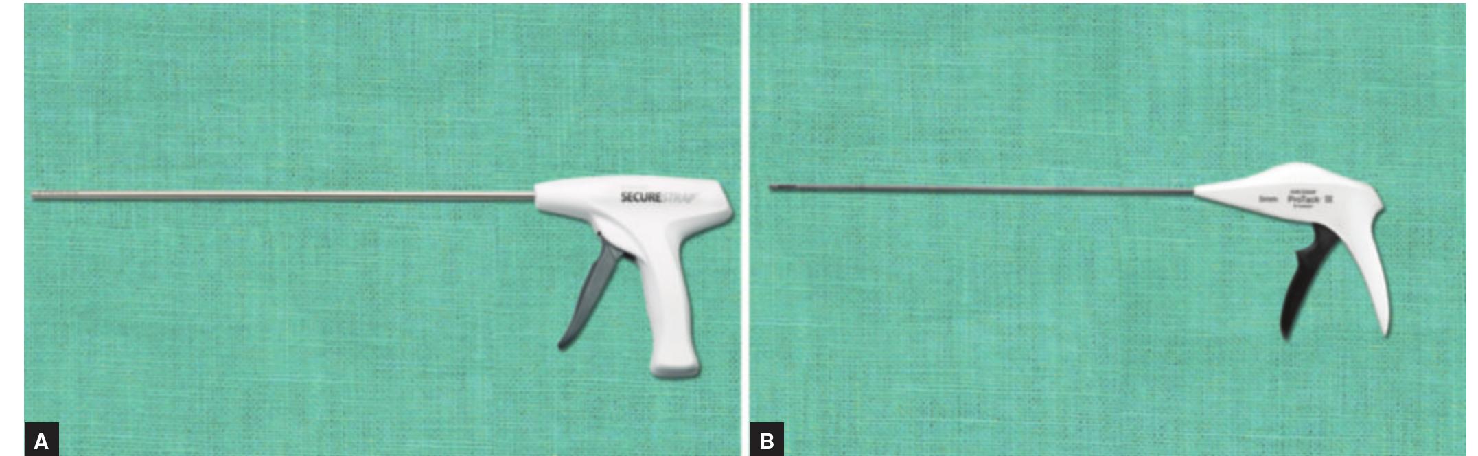 S. 13a and b: (a) hernia secure trap ethicon stapler; (b)