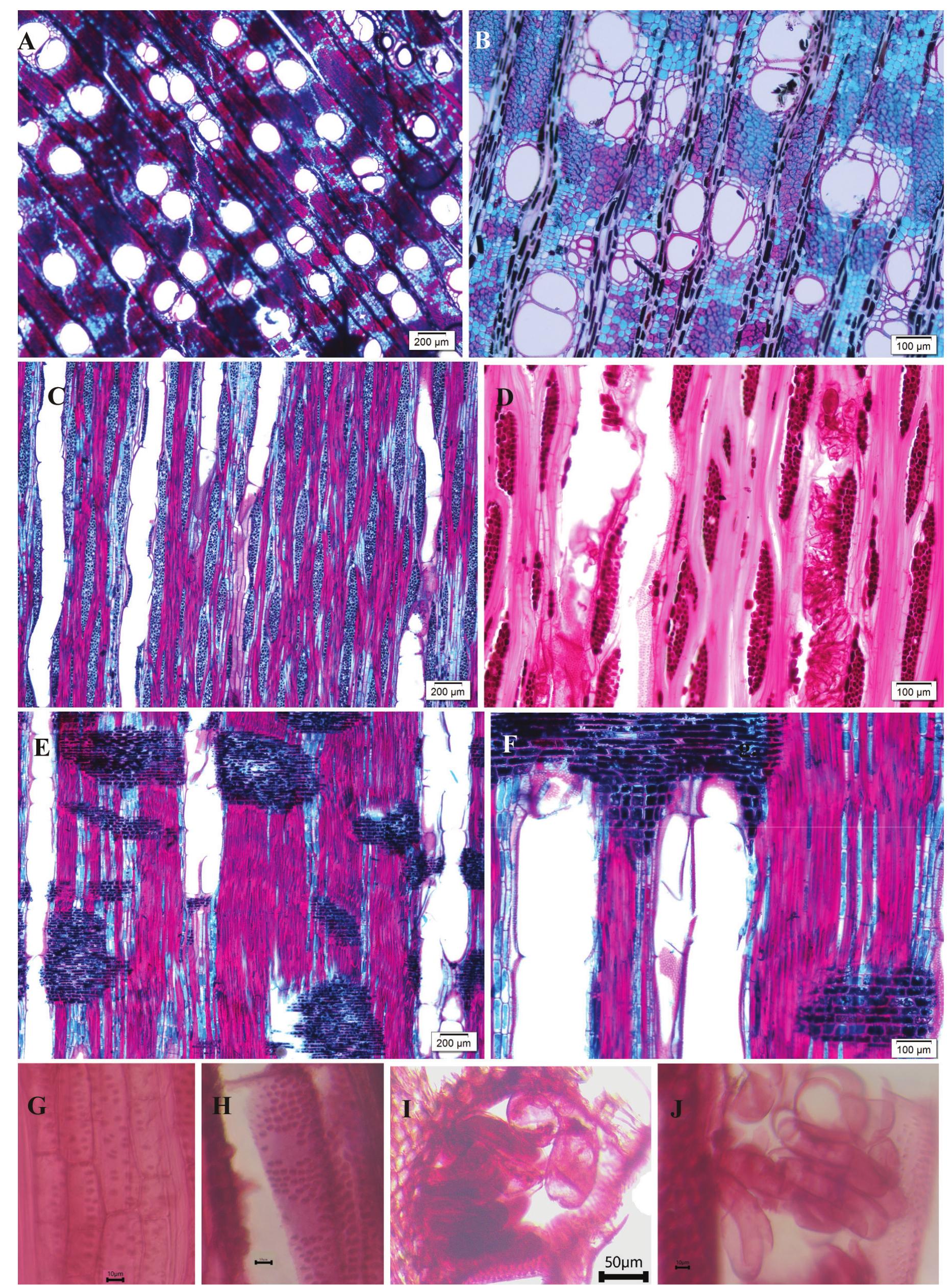 Wood anatomy of shorea robusta, a & b. cross-section of wood