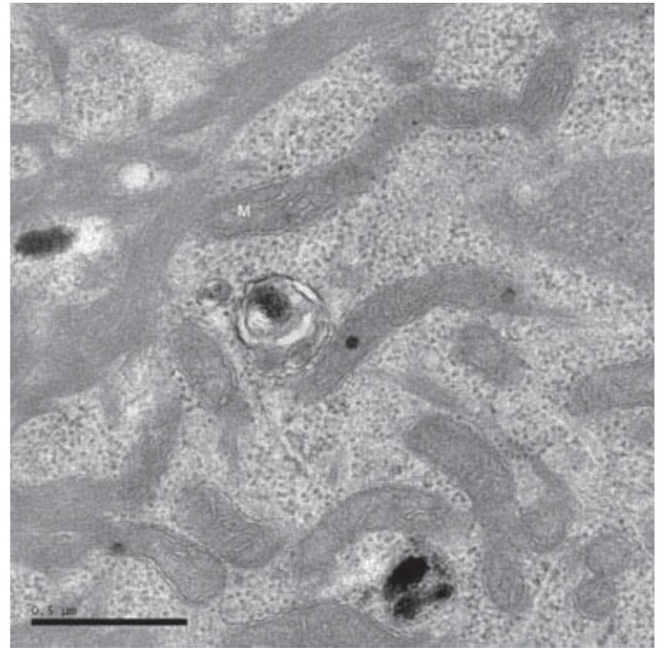 Ultrastructure of human epidermal cell from the stratum