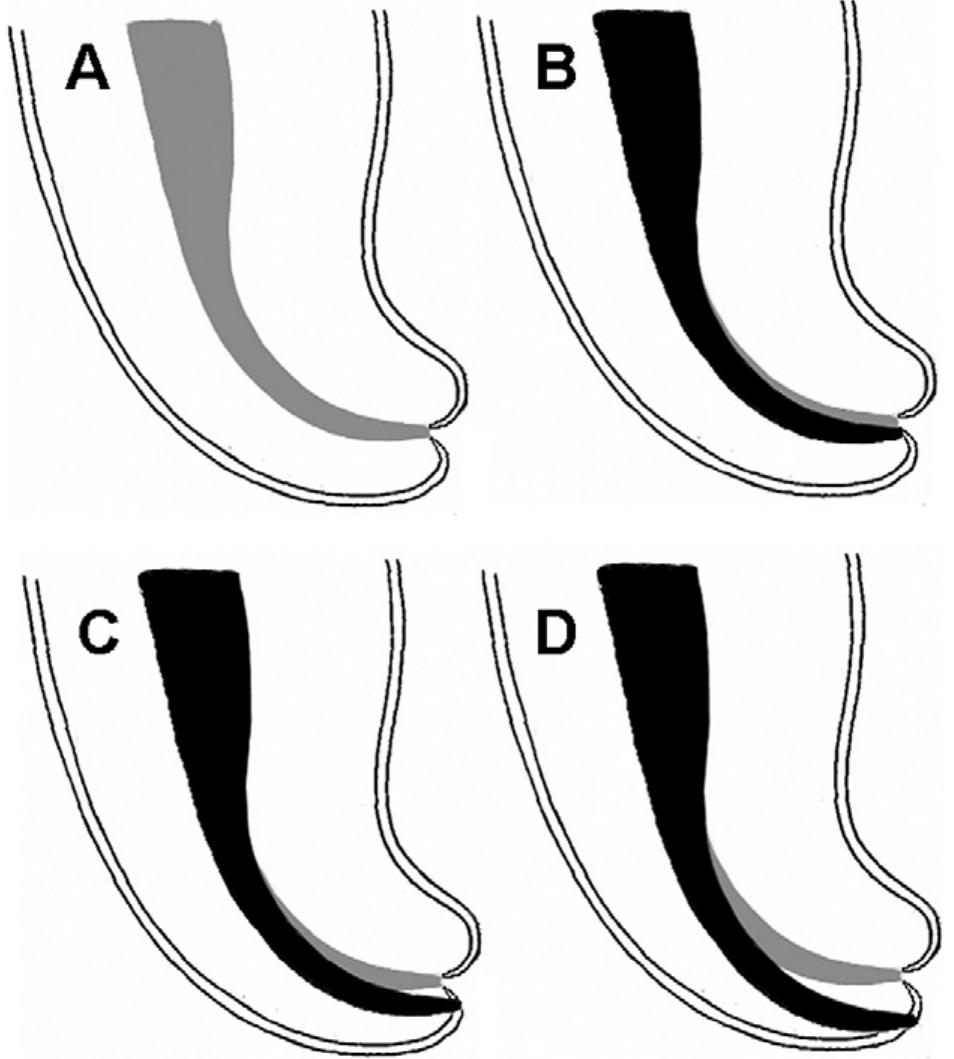 Types of canal transportation. (a) regular canal shape; (b)