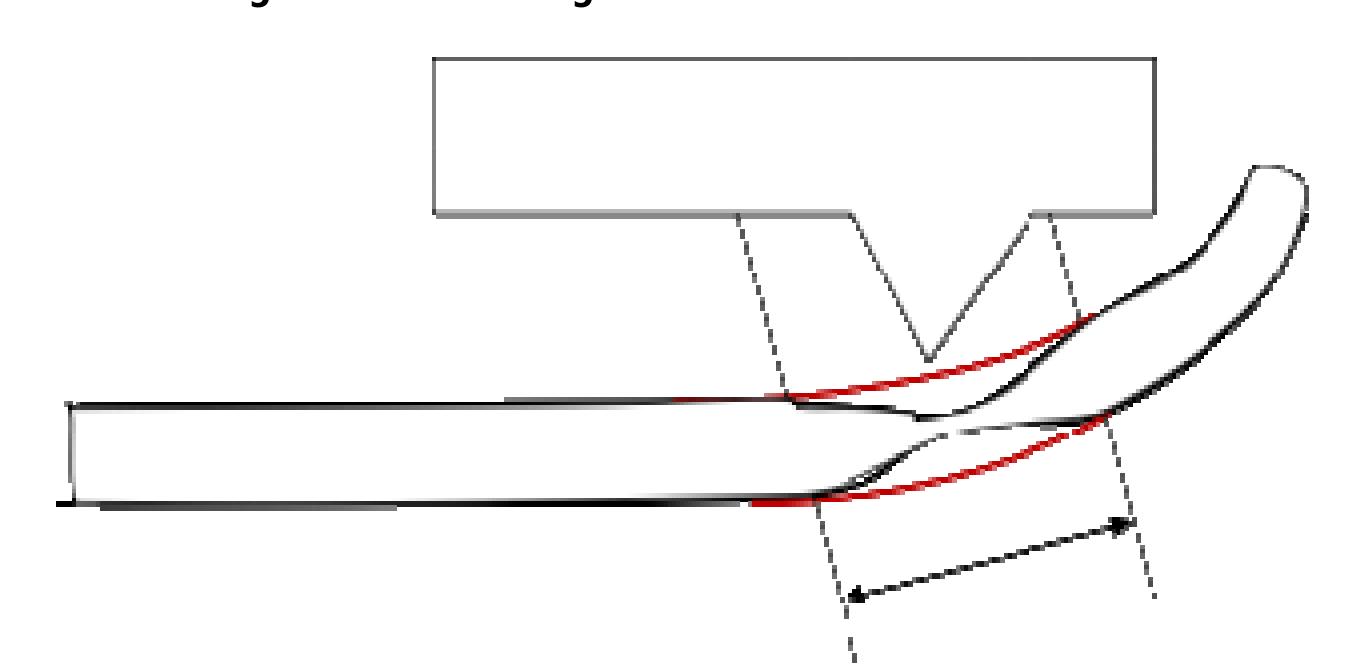 Figure 4 - Ascending Urethrogram and Sonourethrogram in