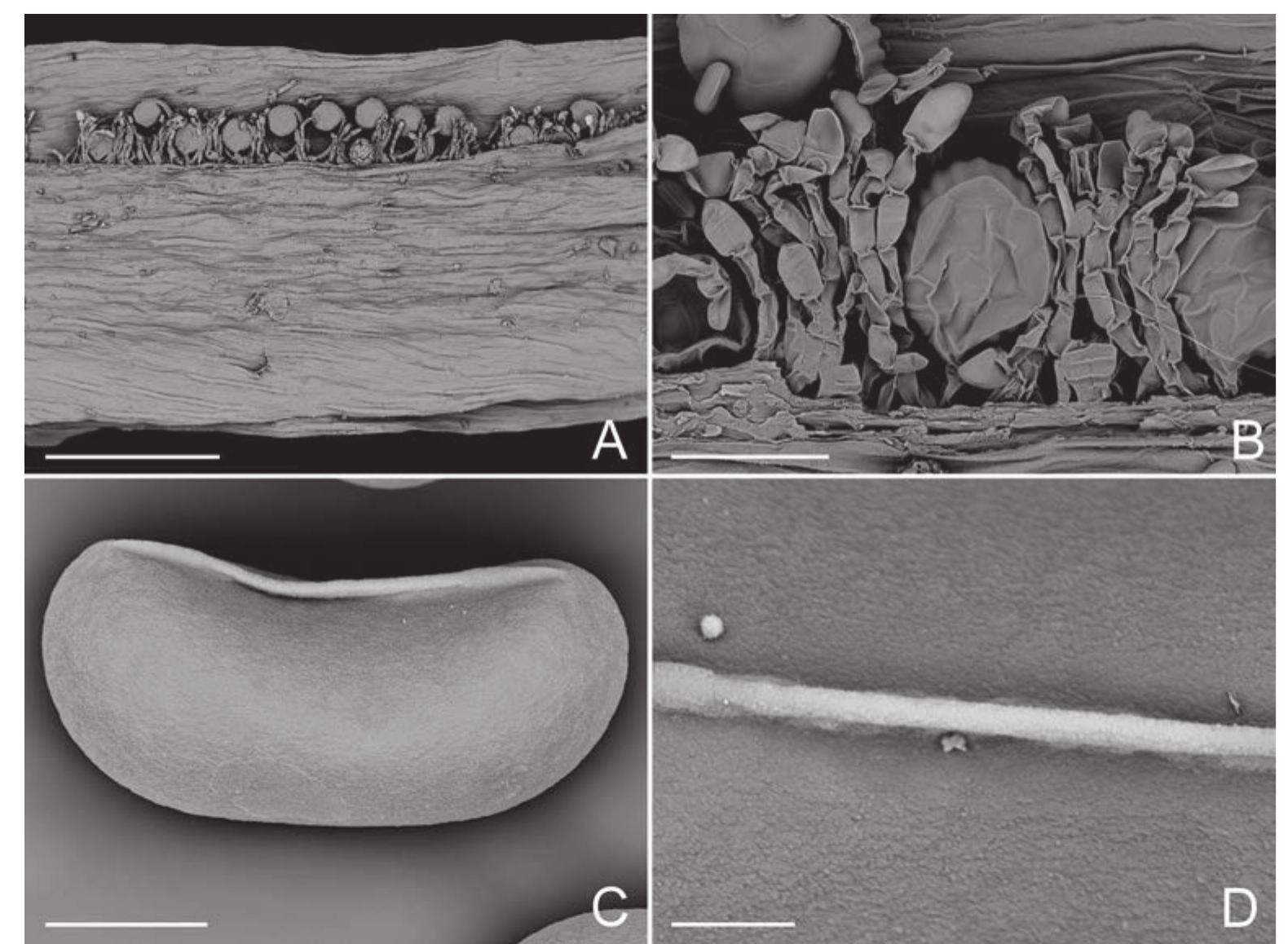 Sem images of the soral paraphyses and spores of haplopteris