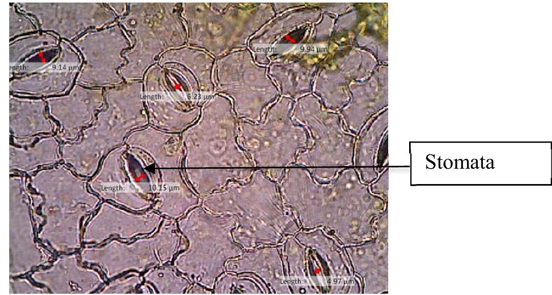 The width of opened stomata pore (40 times magnification)