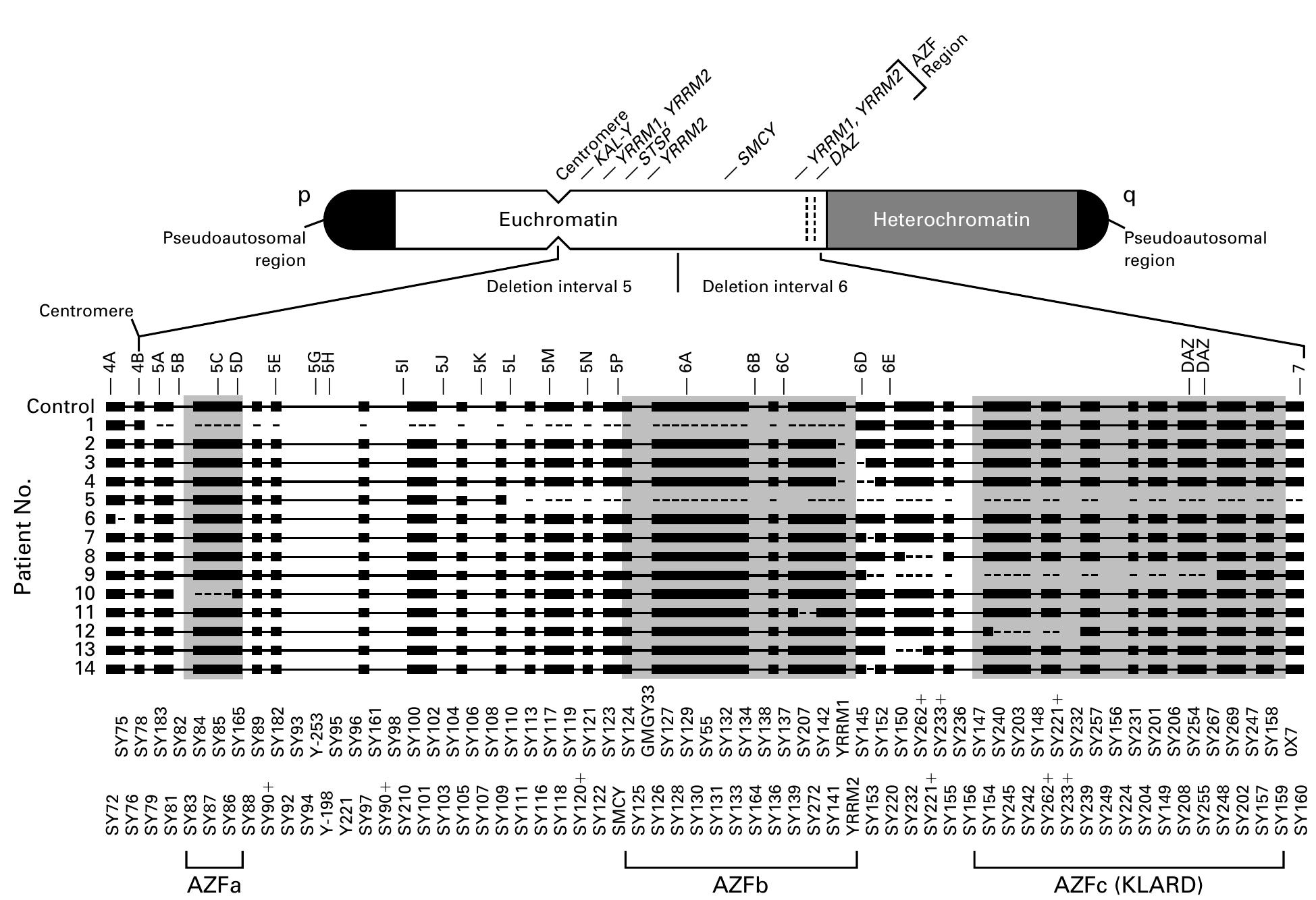 Maps of the y chromosome in 14 men with infertility and
