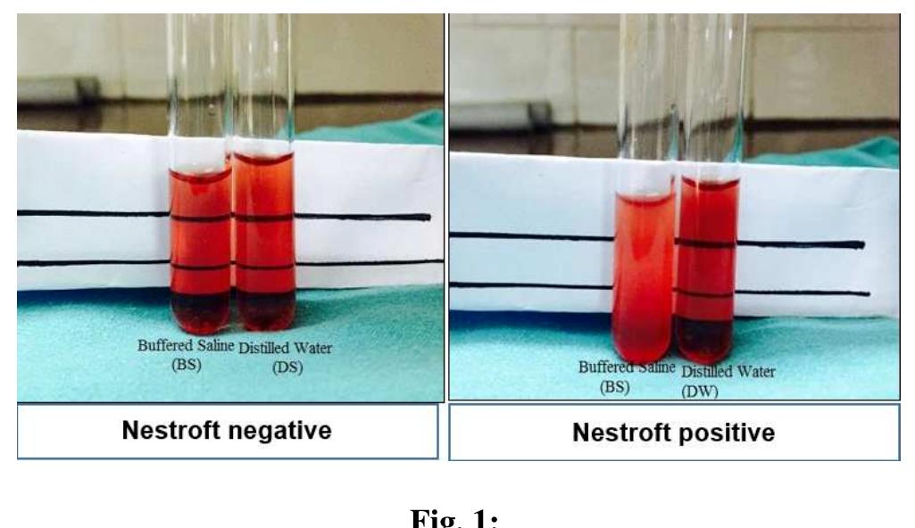 2ml of 0.36% buffered saline was taken in sample test tube