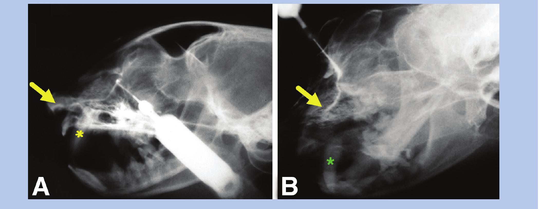 Lateral (a) and oblique (b) radiographic images showing the