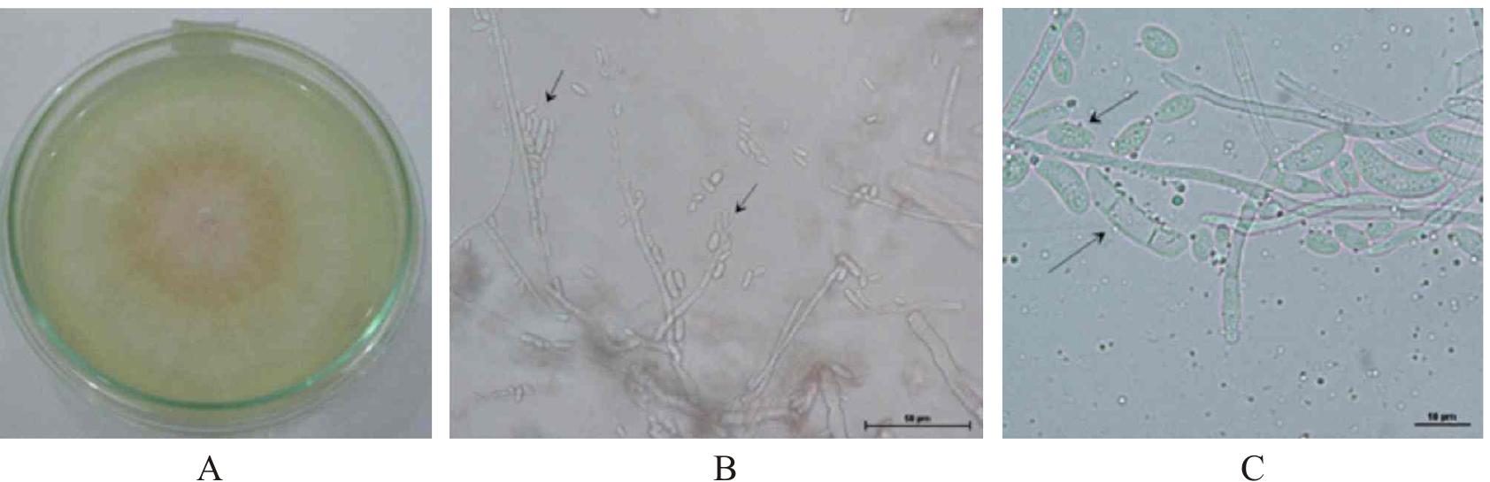 Culture of fusarium growing on potato dextrose agar (a).