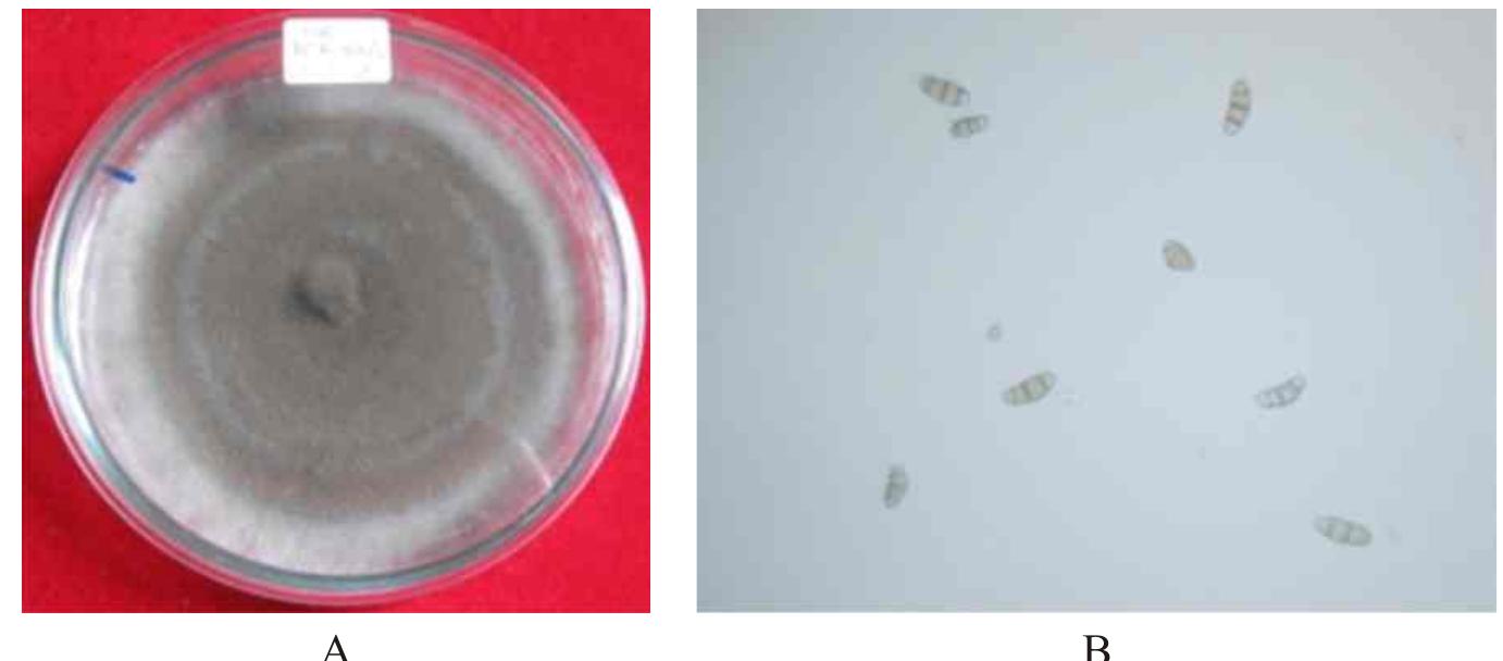 Culture of curvularia growing on potato dextrose agar (a);