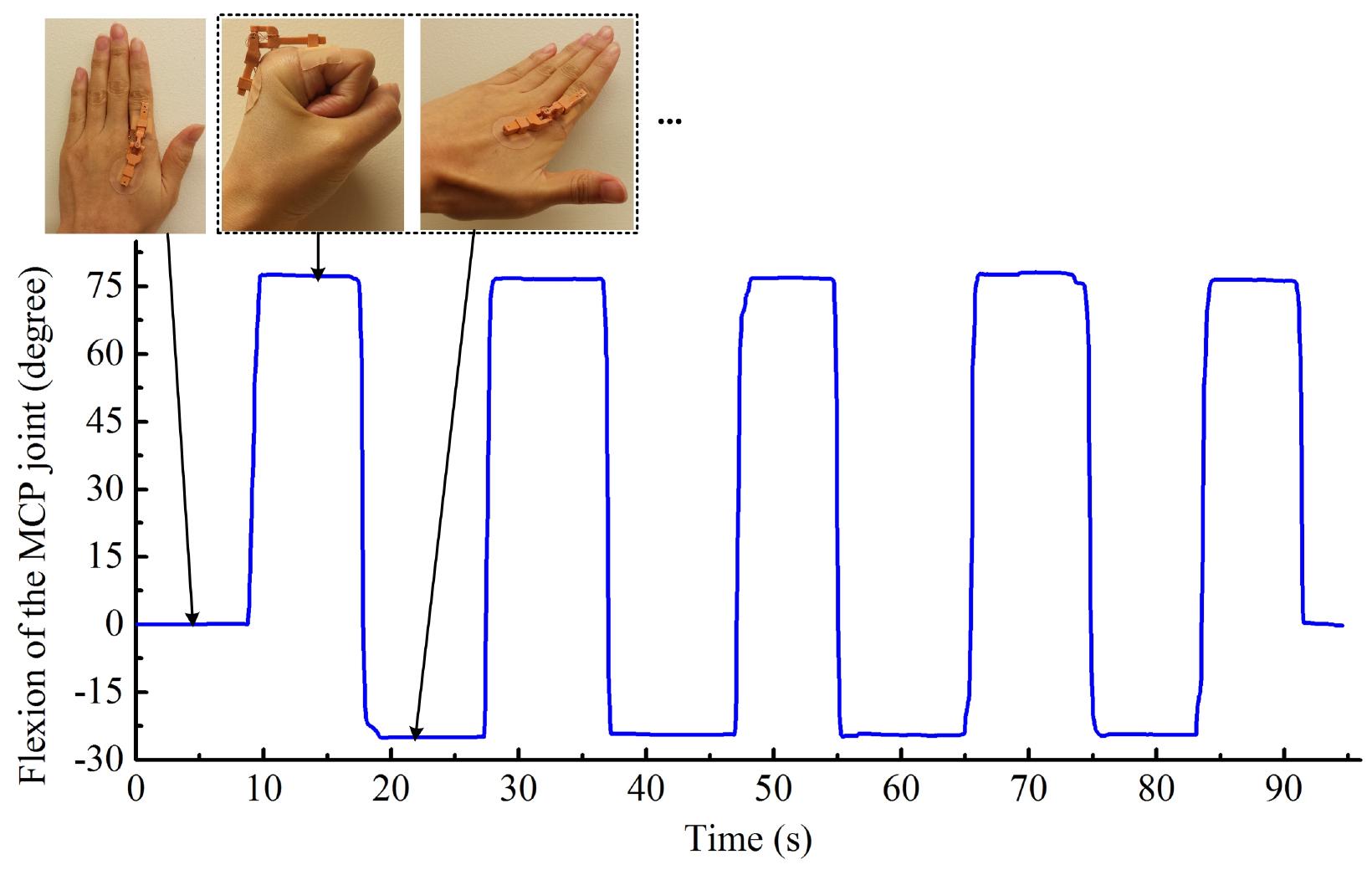 7 the flexion and extension of the mcp joint of the left