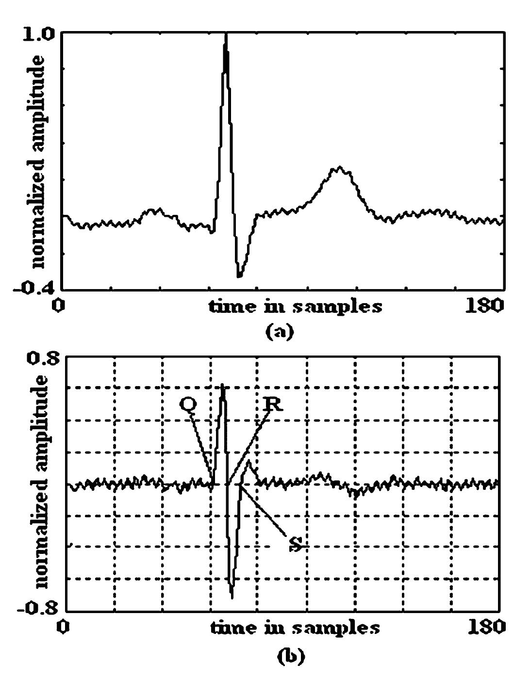 Figure 1 - from Modeling QRS Complex in dECG