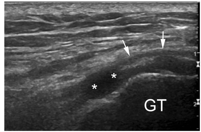 Figure 1 - from Clinical indications for musculoskeletal