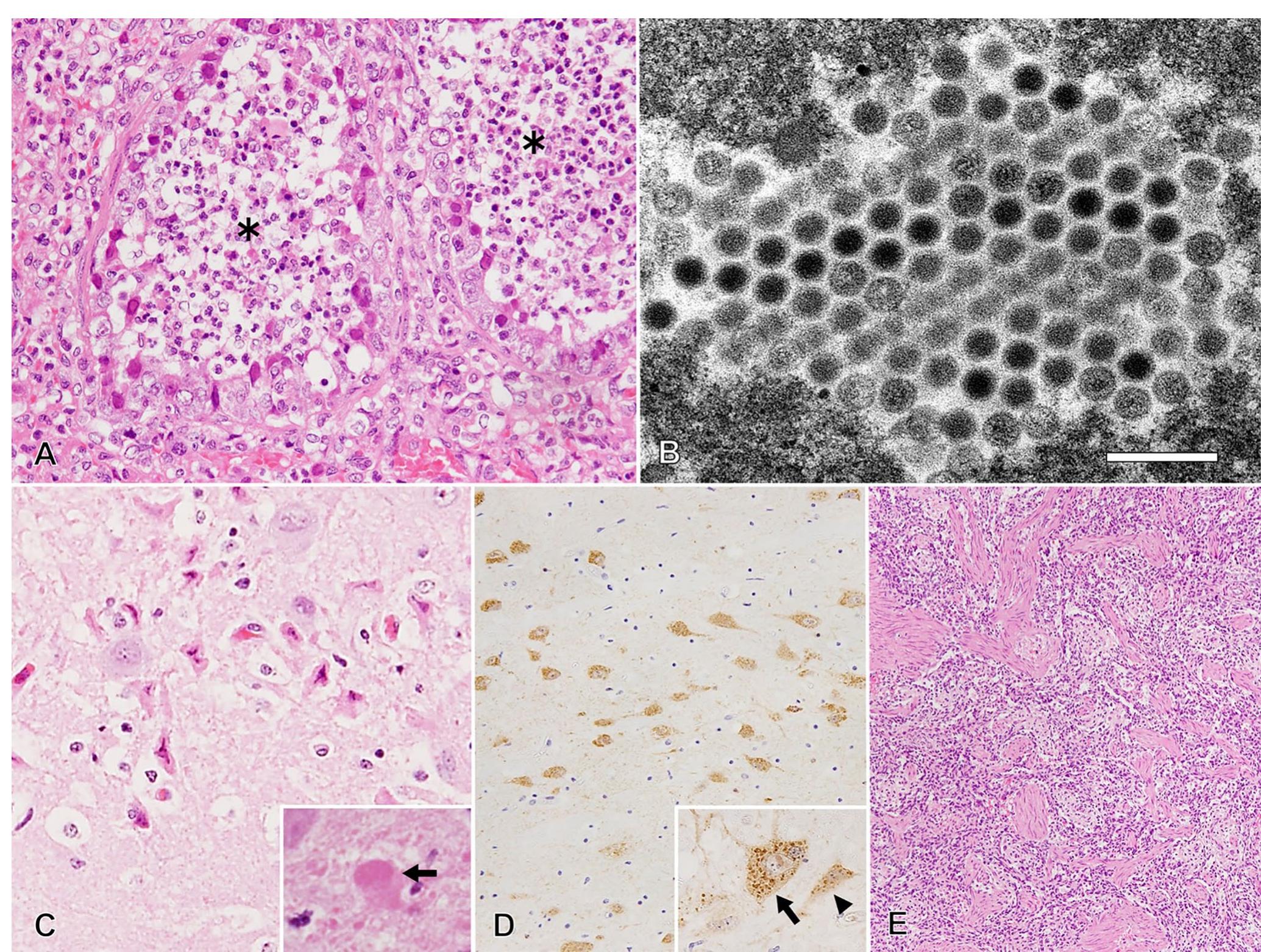 Histologic lesions of vaccine-induced canine distemper virus