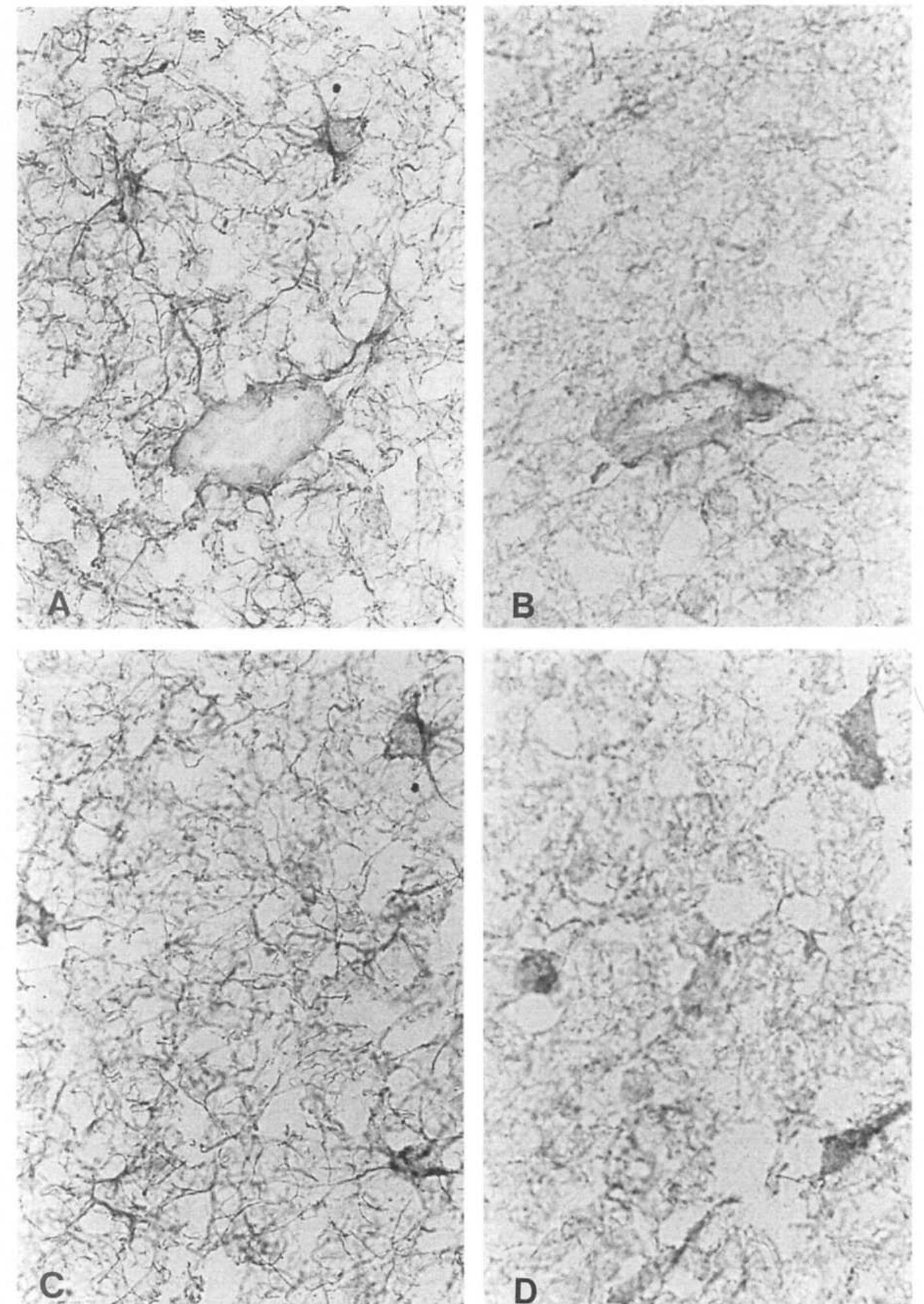 Immunoperoxidase micrographs of human white matter tissue