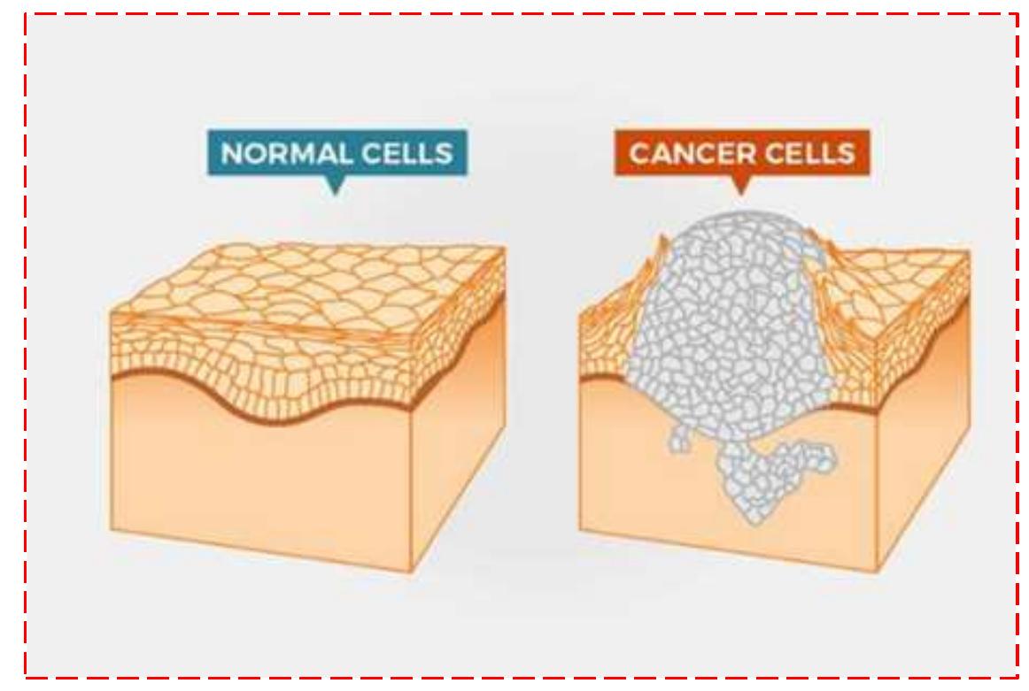 -8: an example of normal cells versus cancer cells [156].