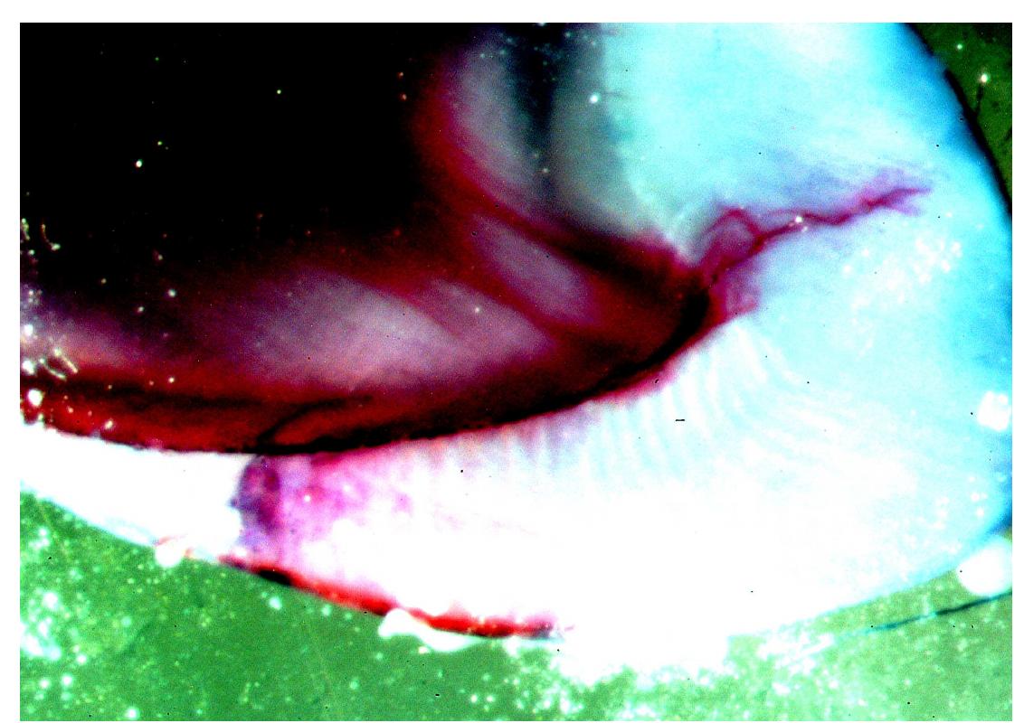 Sample histological tooth section with a proximal-surface
