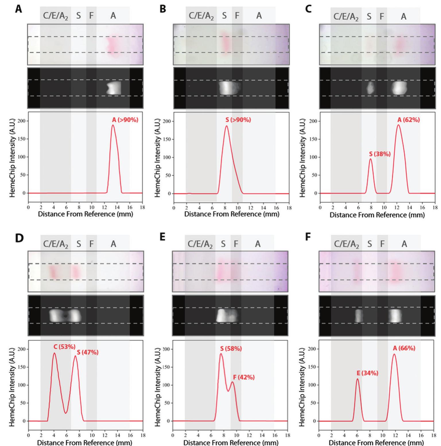 Identification of hemoglobin types and quantification of