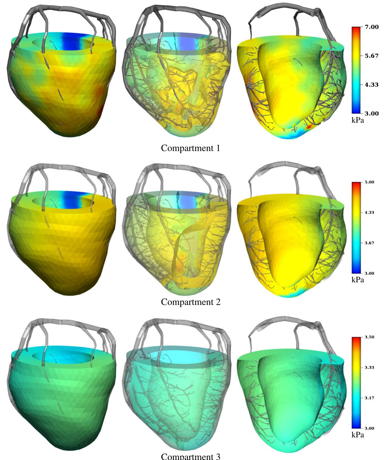 Pressure in compartments 1-3 visualized on the surface