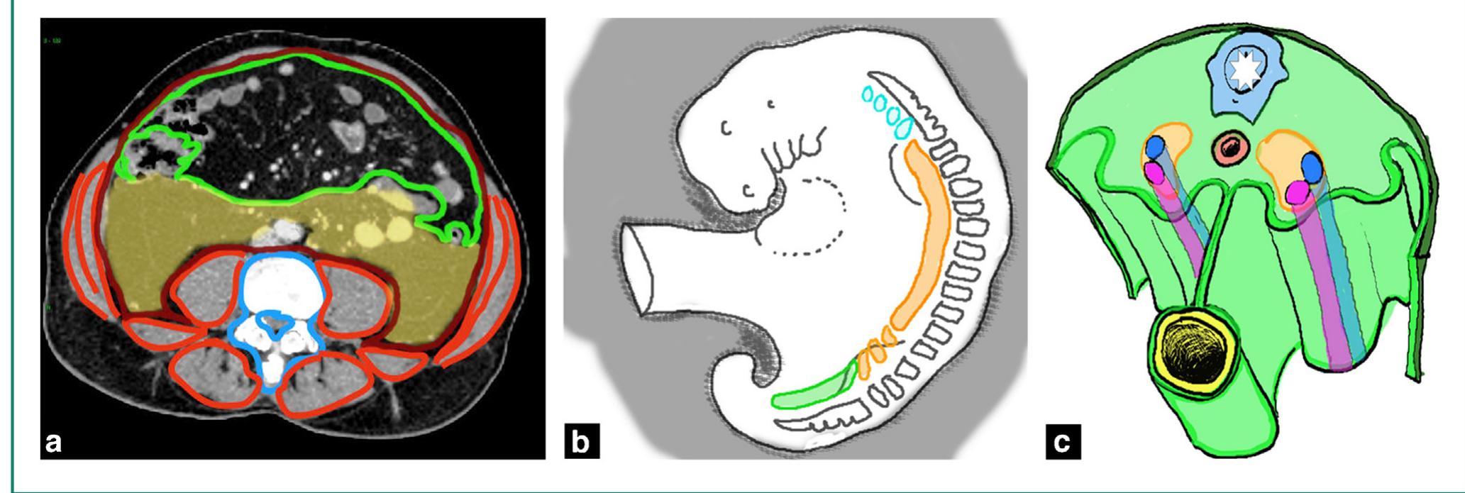 Diagram of the embryological origins of the components of