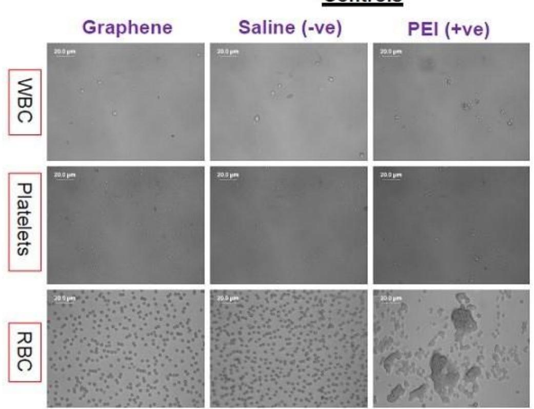 N8: blood cell aggregation on incubation of graphene with