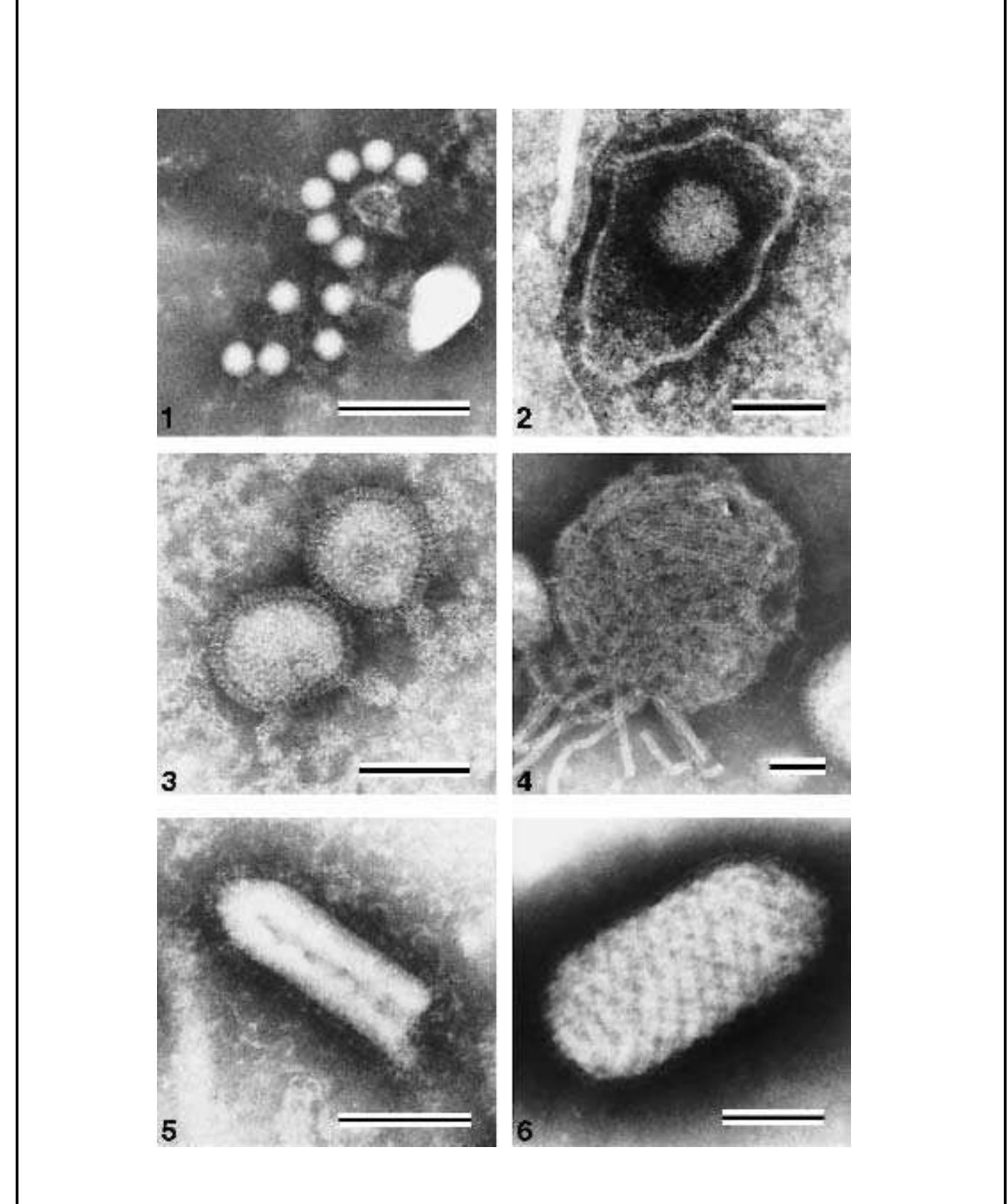 1.) morphological forms of viruses: 1. poliovirus, naked rna