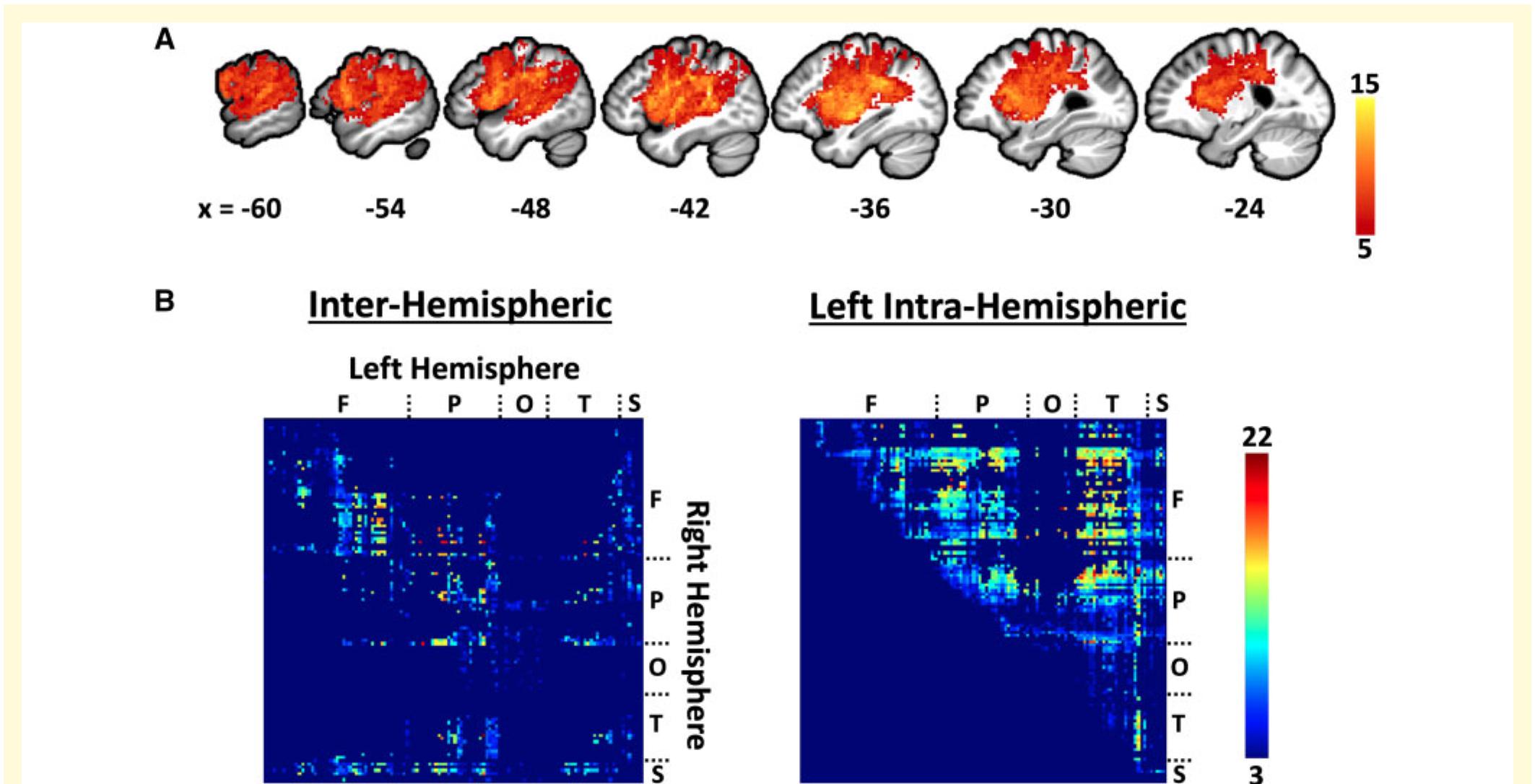 Lesion overlap maps. (a) voxel-wise lesion overlap map with