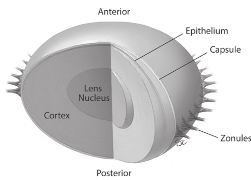 Sectional view showing the layers of the lens. the cataract
