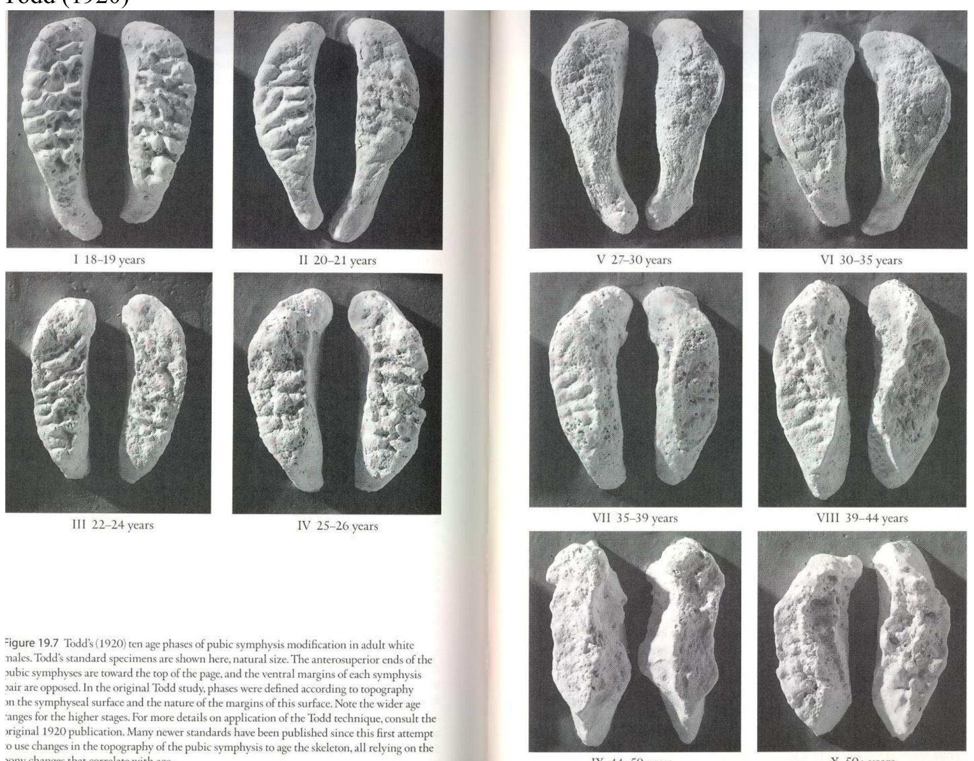 I (18-19): symphyseal surface rugged, transverse by