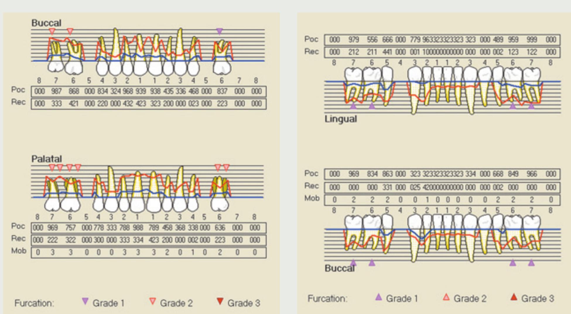 Periodontal charting of mandibular teeth. fig g6 periodontal