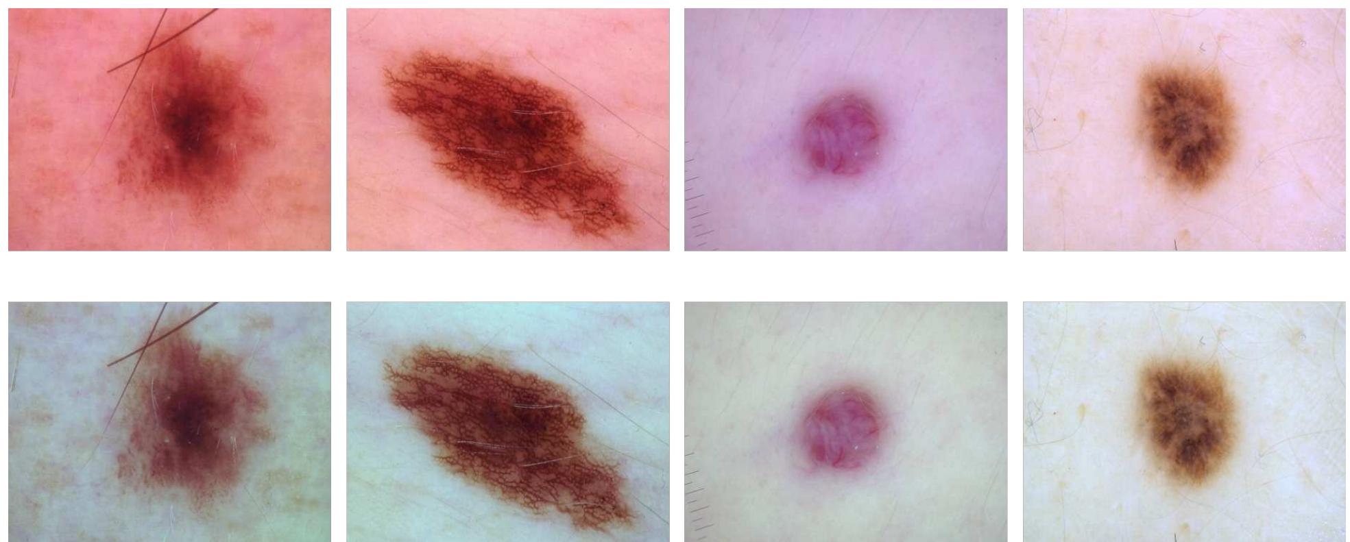 Examples of skin lesion images after preprocessing: (top)