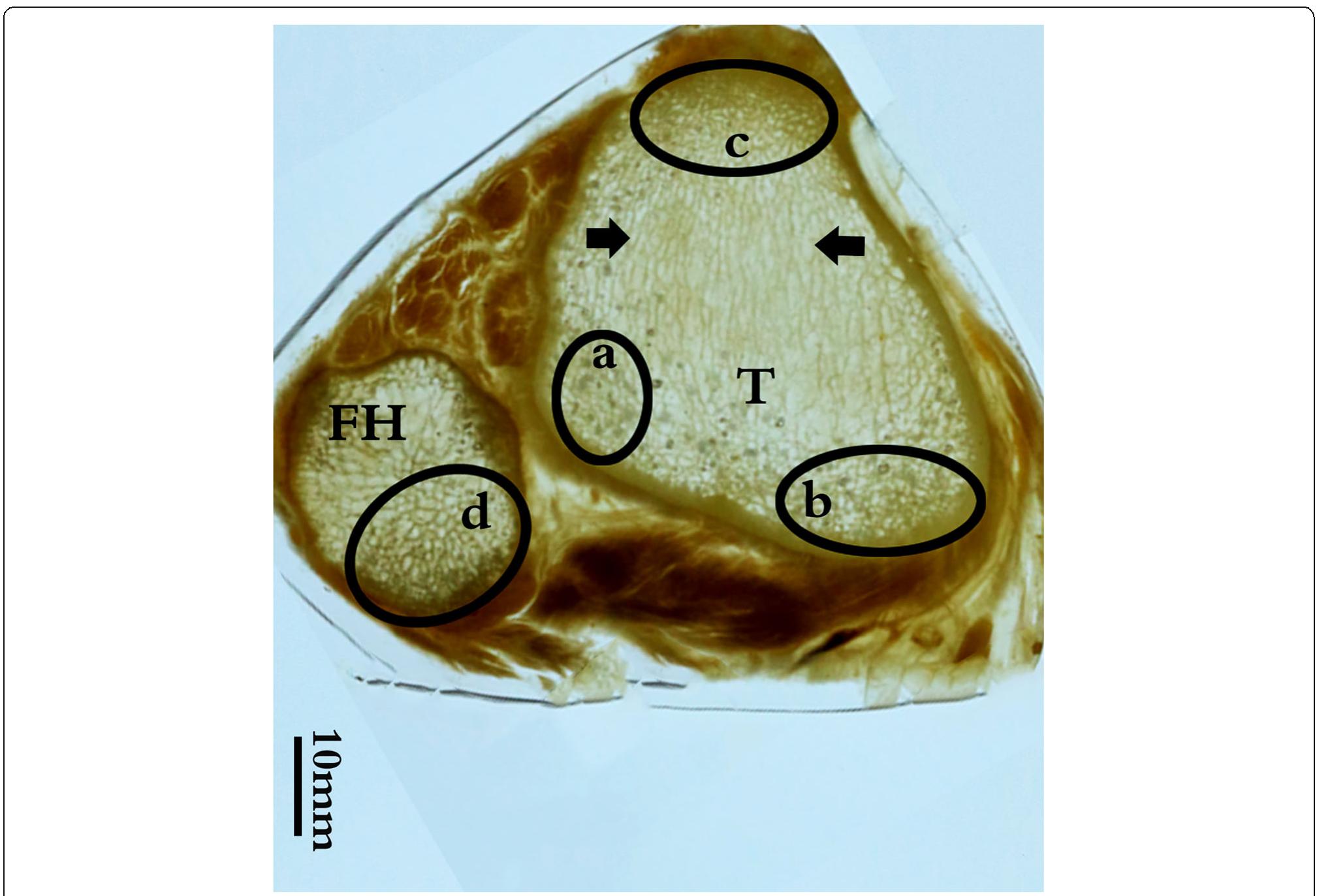 Axial p45 section of the knee joint through the tibiofibular