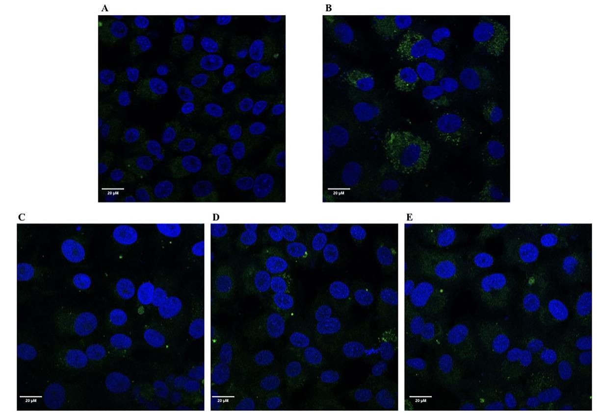 Confocal microscopy images of vero e6 cells after