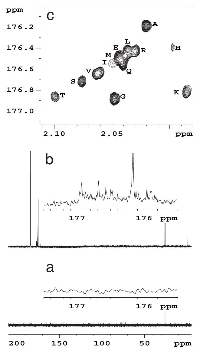 '3c nmrspectrum of normal human serum after protein