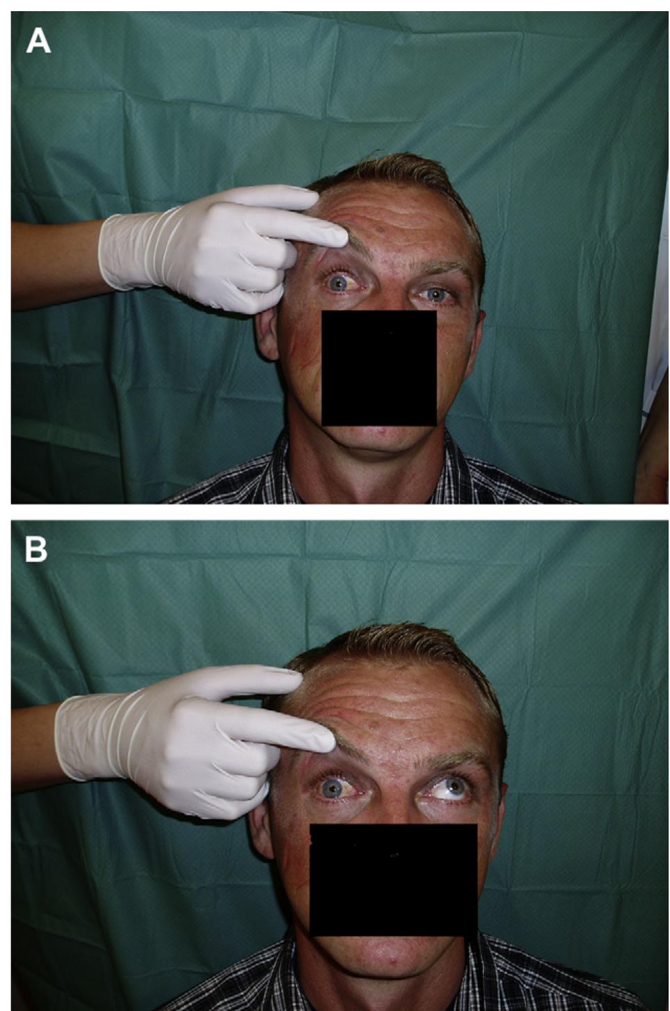 patient in the day of discharge from hospital. (a)
