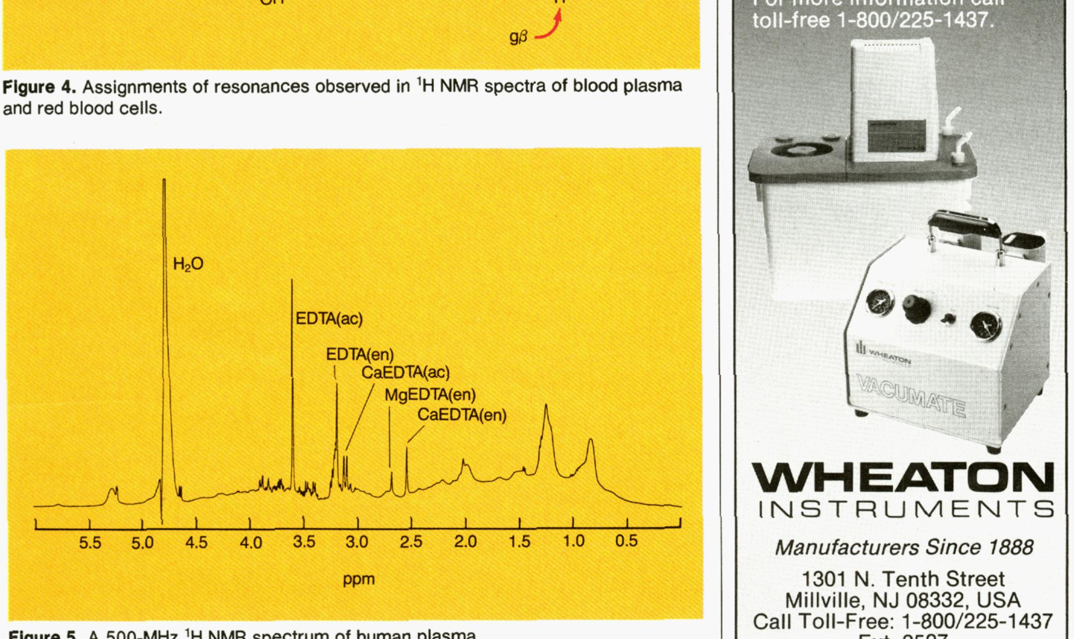 Figure 8 - Proton NMR Spectroscopy of Human Blood Plasma and