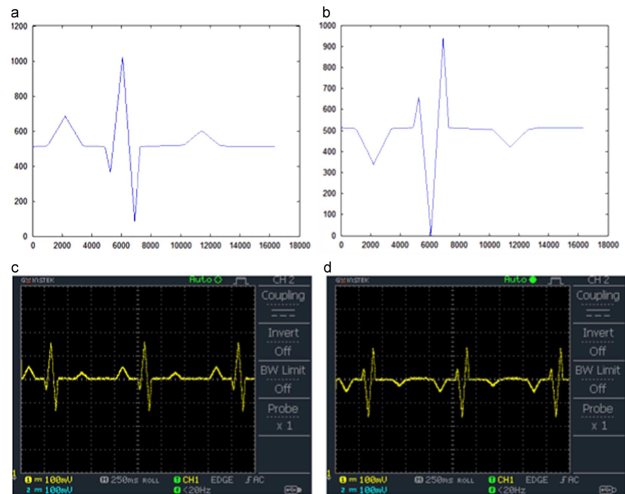 The ecg signal of lead1 and avr buses. fig. 2. the diagram