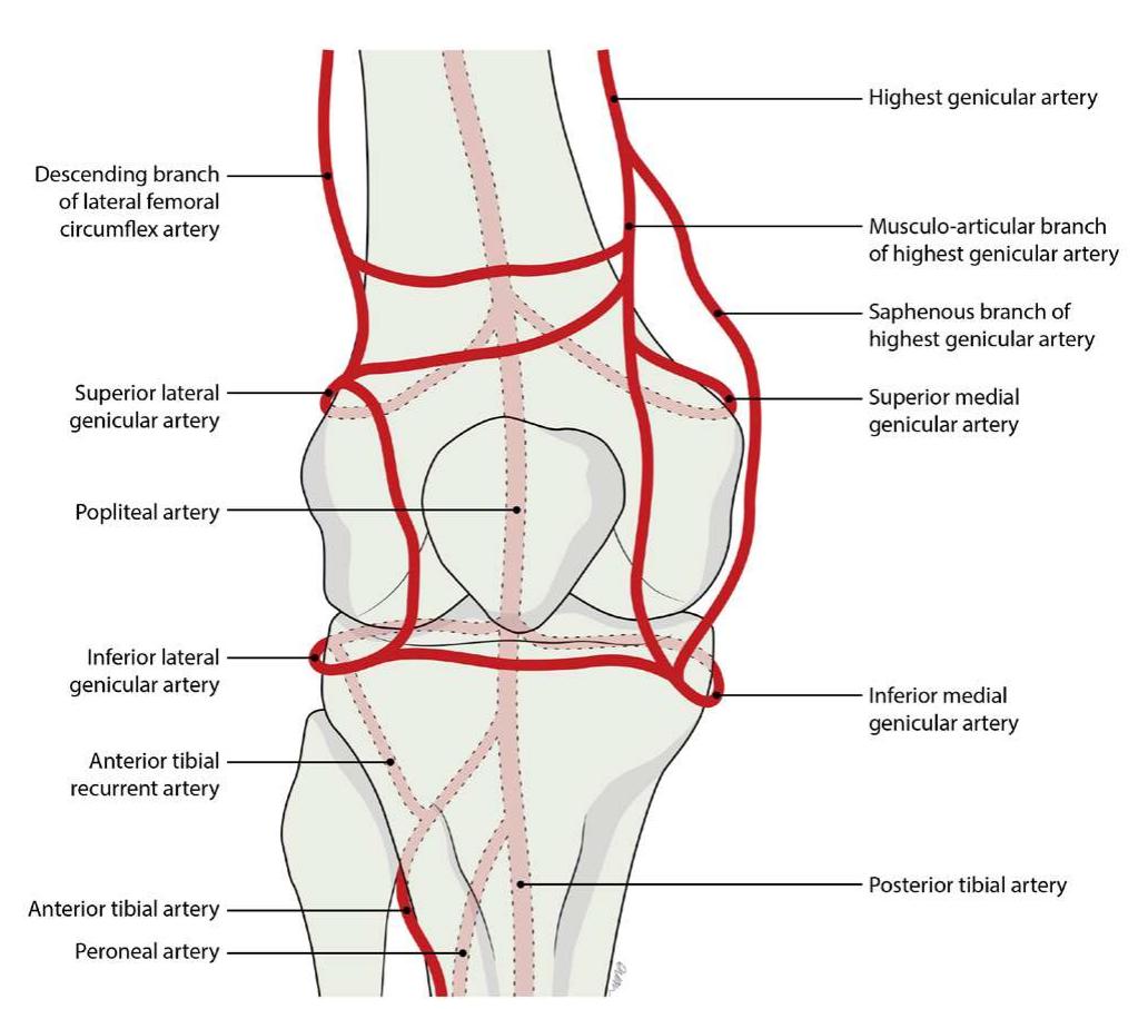 Descending Genicular Artery Perforator Flap