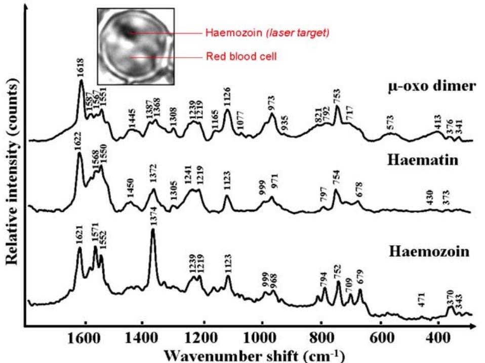 Resonance raman spectra of haemozoin in live red blood