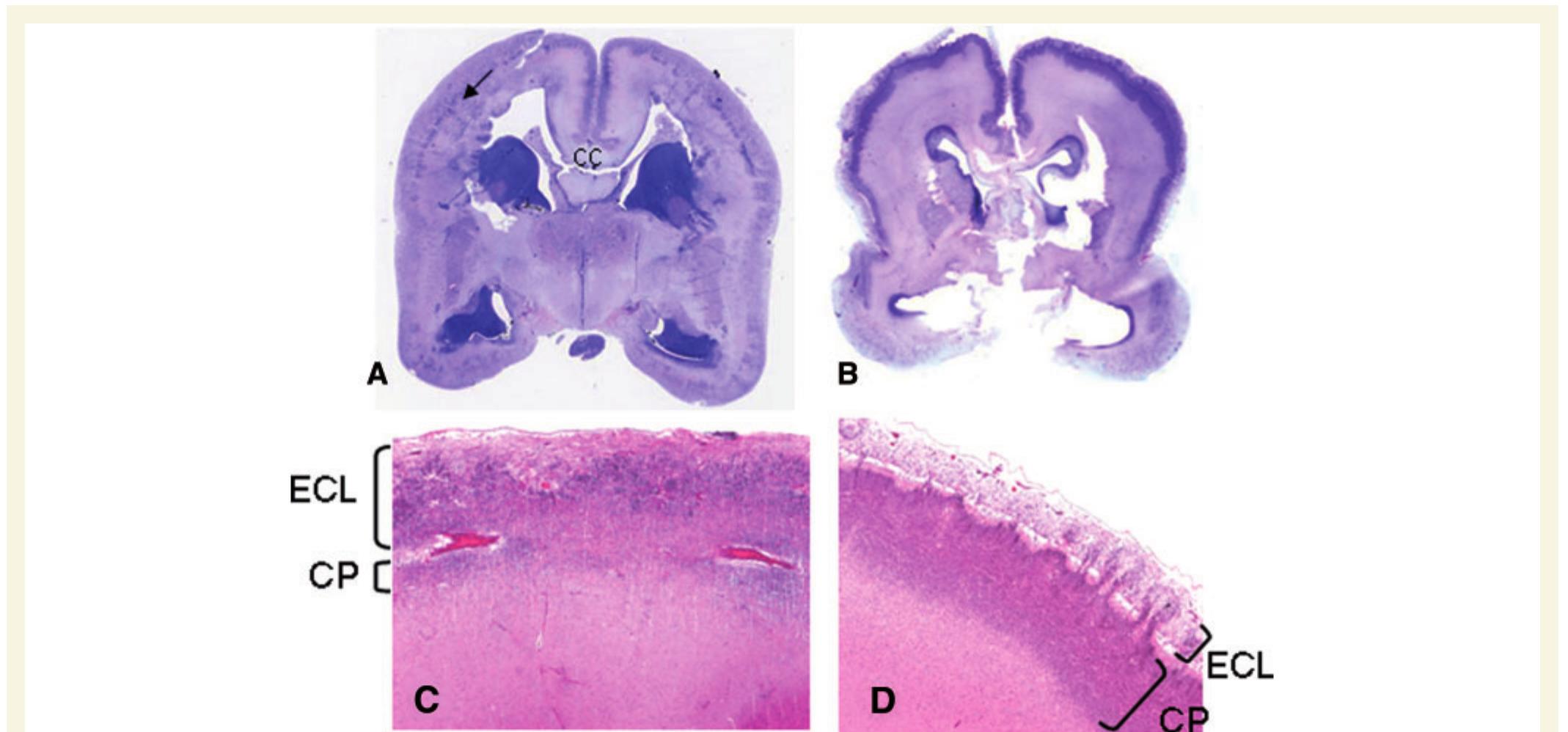 Whole-mount coronal sections of cerebral hemispheres in