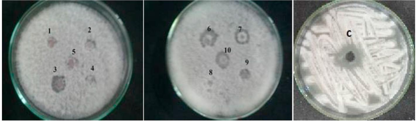 The antifungal (fusarium) activity of different streptomyces