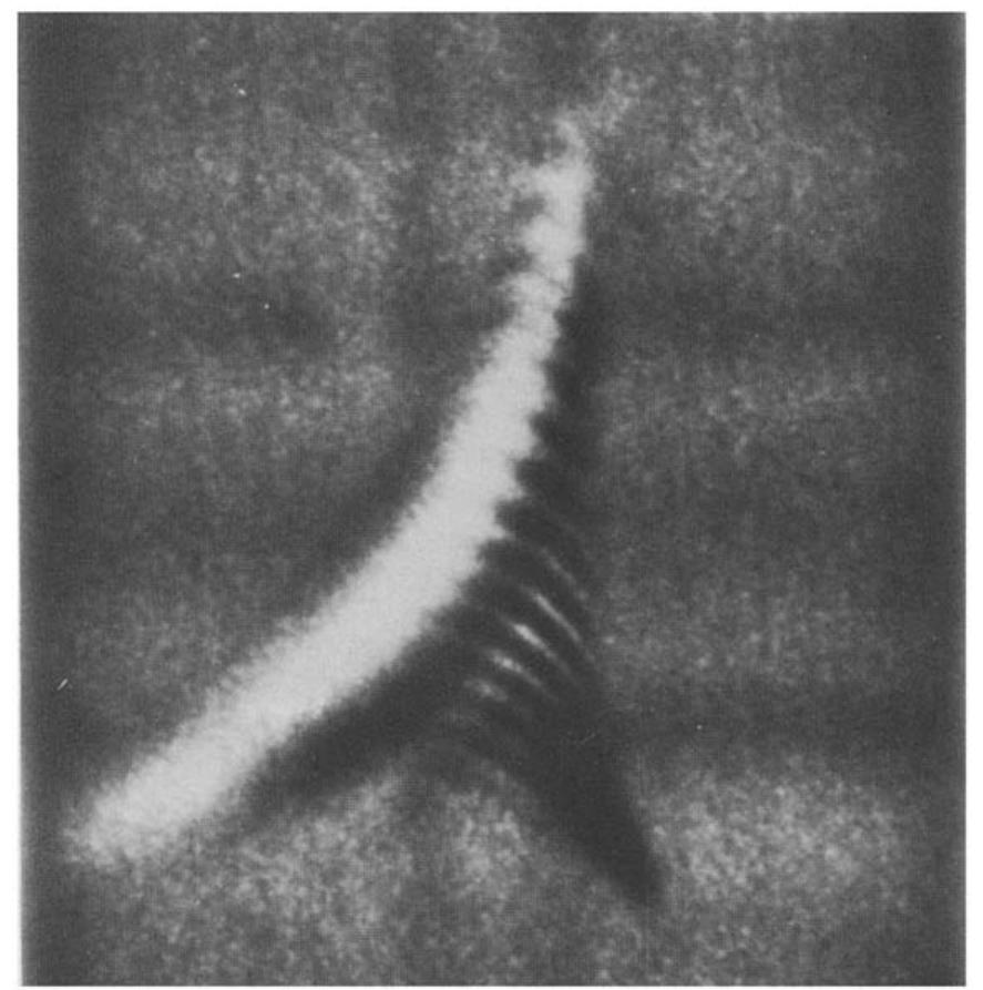 Image of an inclined straight dislocation in a section