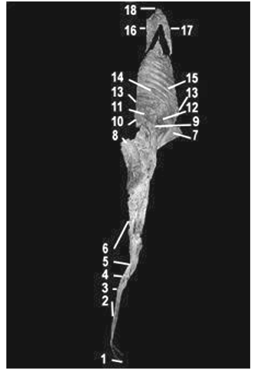 Lateral line cadaveric dissection photograph. courtesy of