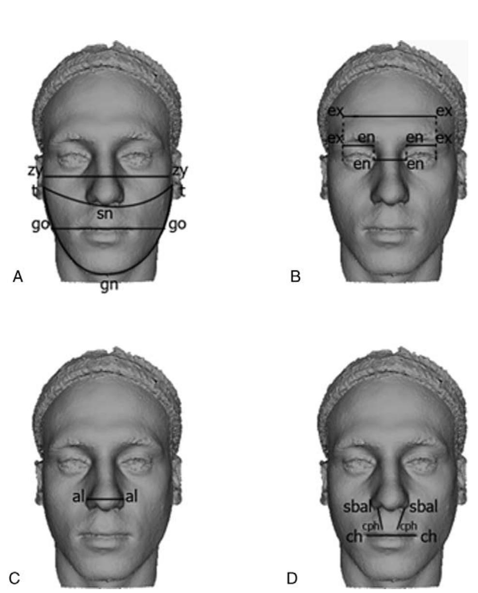 Horizontal measurements: a, face; b, orbits; c, nose; and d,